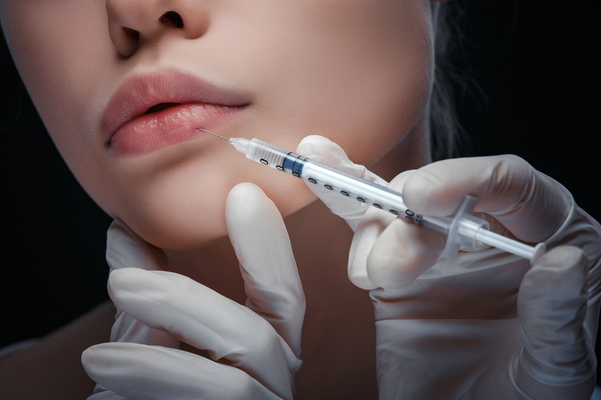 Volbella Lip Fillers: Advanced Lip Enhancement - DoctorMedica